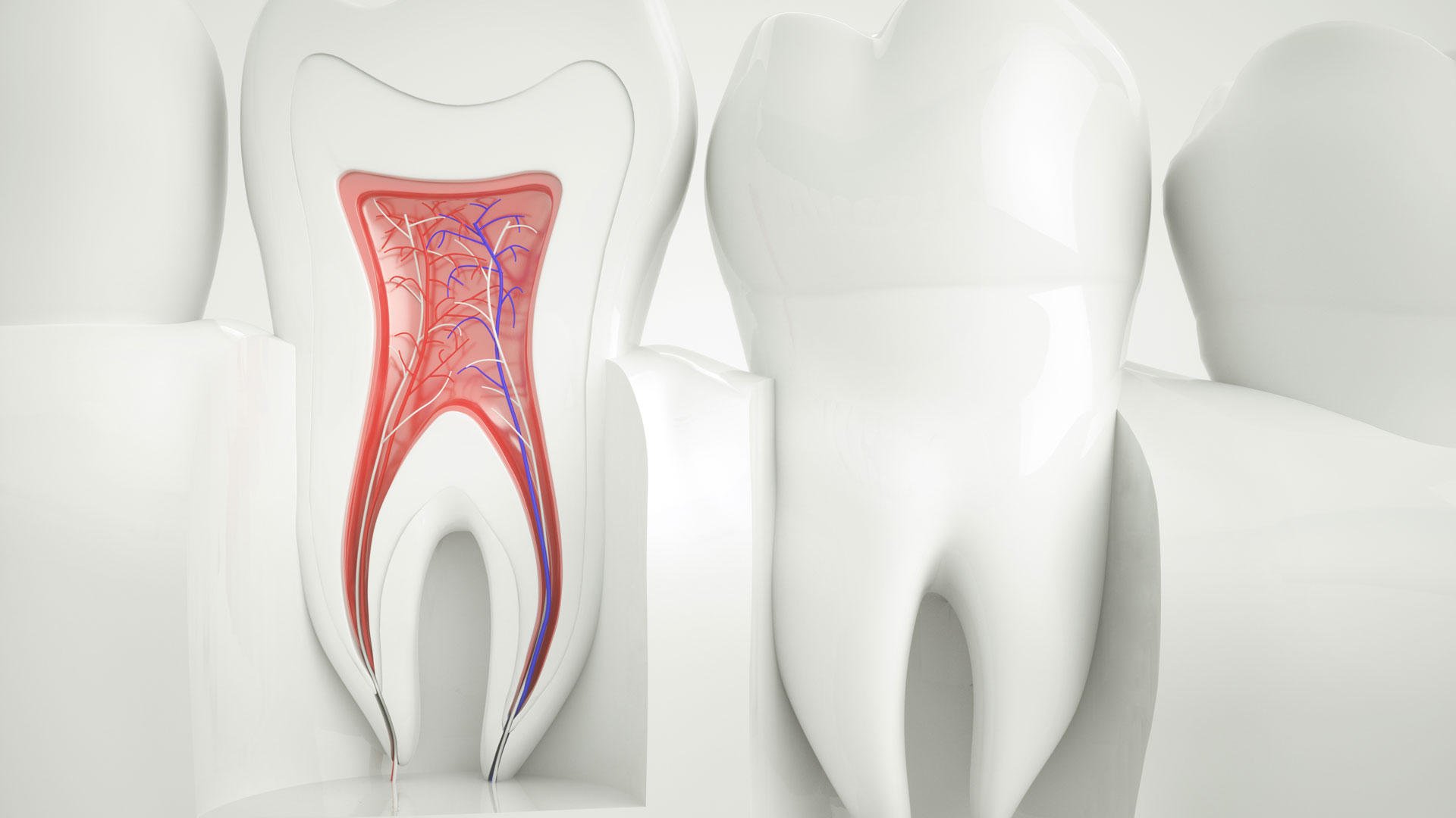 Root Canal in Cape Coral, FL | Dental Blush – Cape Coral, FL