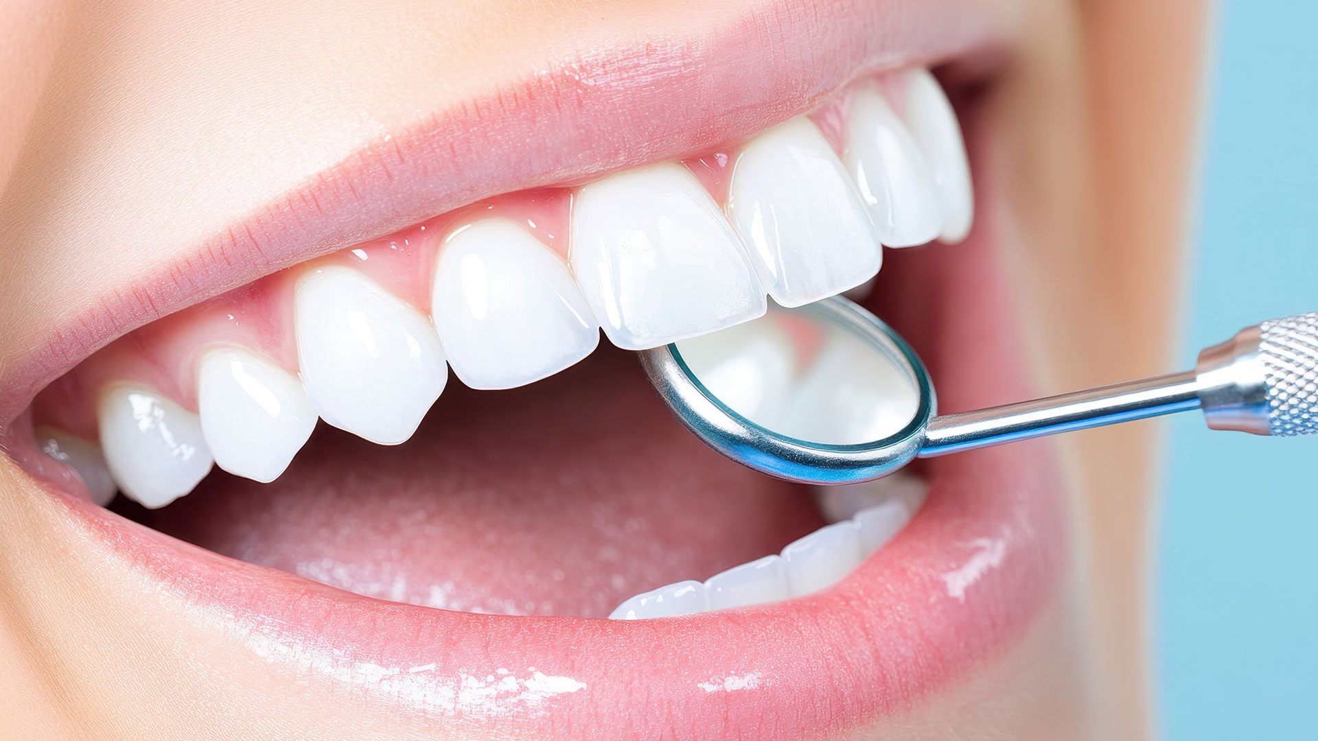 Dental Smile Design in Tamiami/Miami, FL | Dental Blush