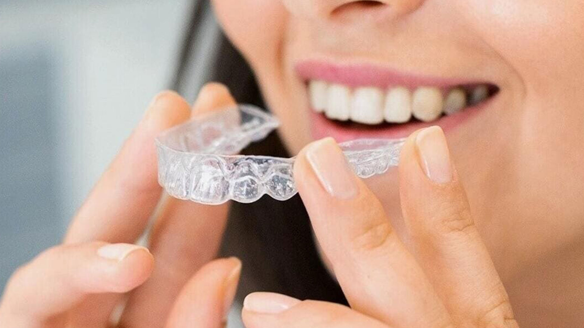 Invisalign in Tamiami, FL | Dental Blush